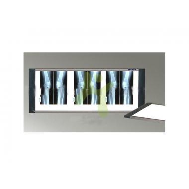 Healthy Medical Company Ltd. | LED X-Ray Film Viewer, Ultra Slim