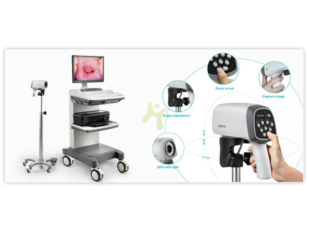 Healthy Medical Company Ltd. | EDAN Video Colposcope Model: C6