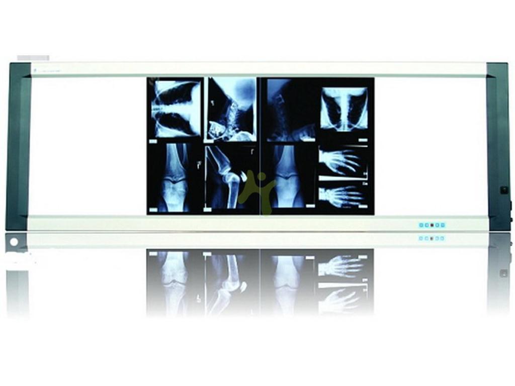 Healthy Medical Company Ltd. | LED X-Ray Film Viewer, Ultra Slim